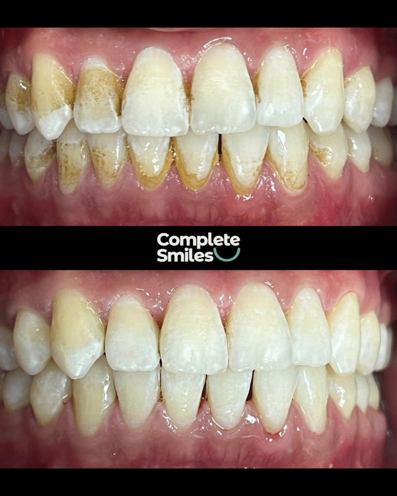 Complete Smiles Norway