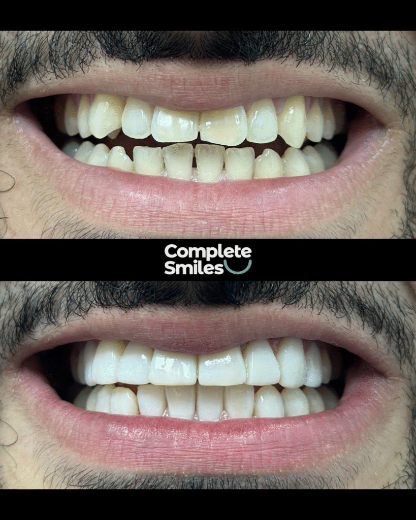 Complete Smiles Norway